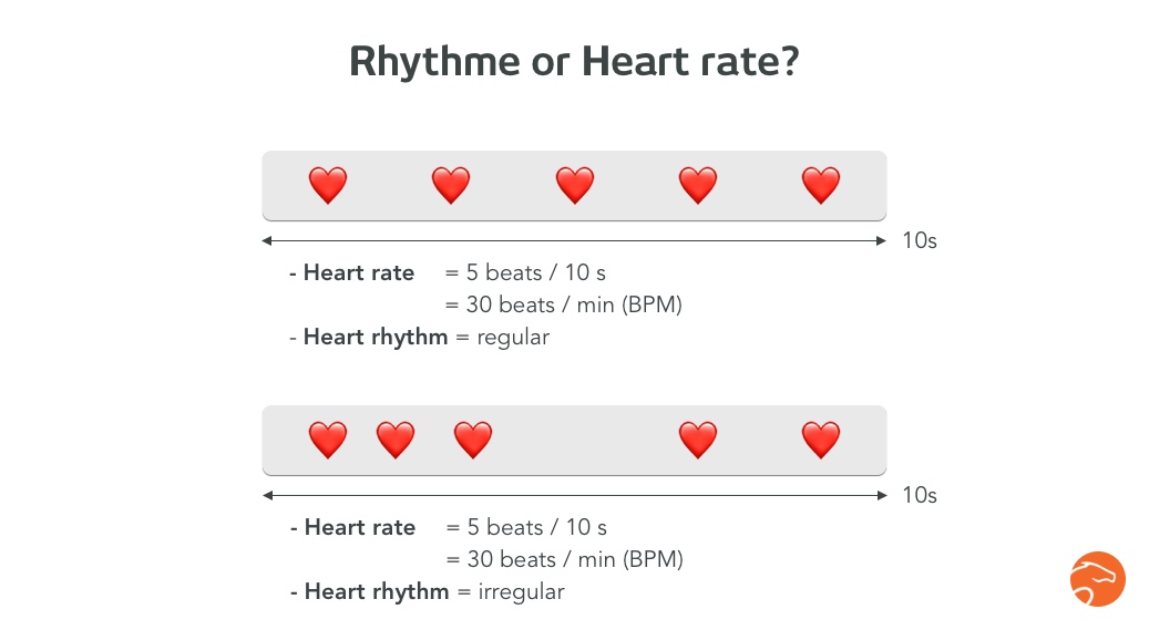 Arrhythmia in Horses: How Serious Are They? | Equisense - Blog
